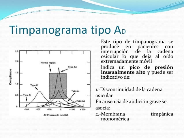 timpanometría por Lourdes Ramírez Ramírez