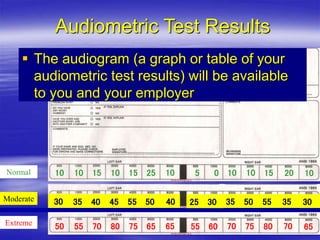 Audiometric Testing.ppt