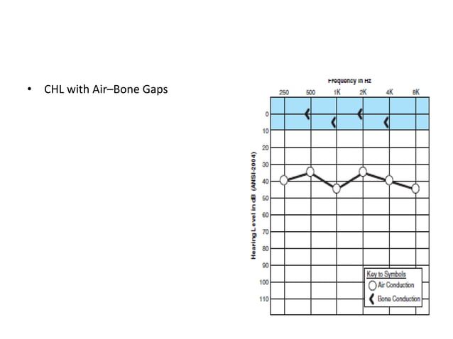 Audiometry | PPTX