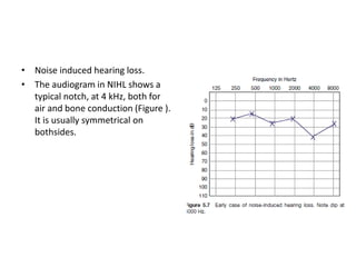 Nihl Audiogram