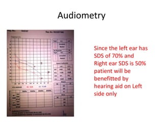 Audiometry | PPTX