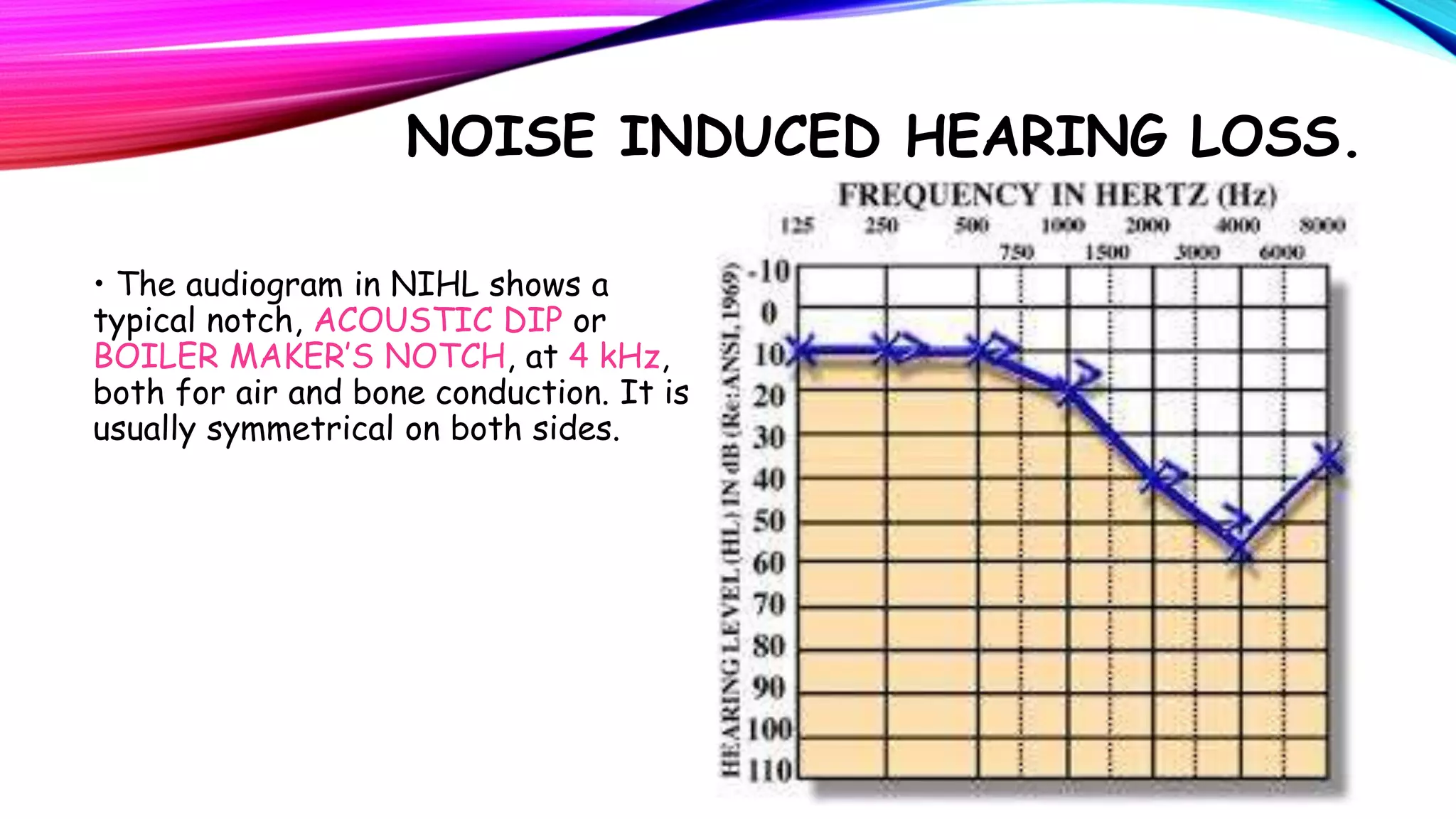 Audiometry Ashly | PPTX