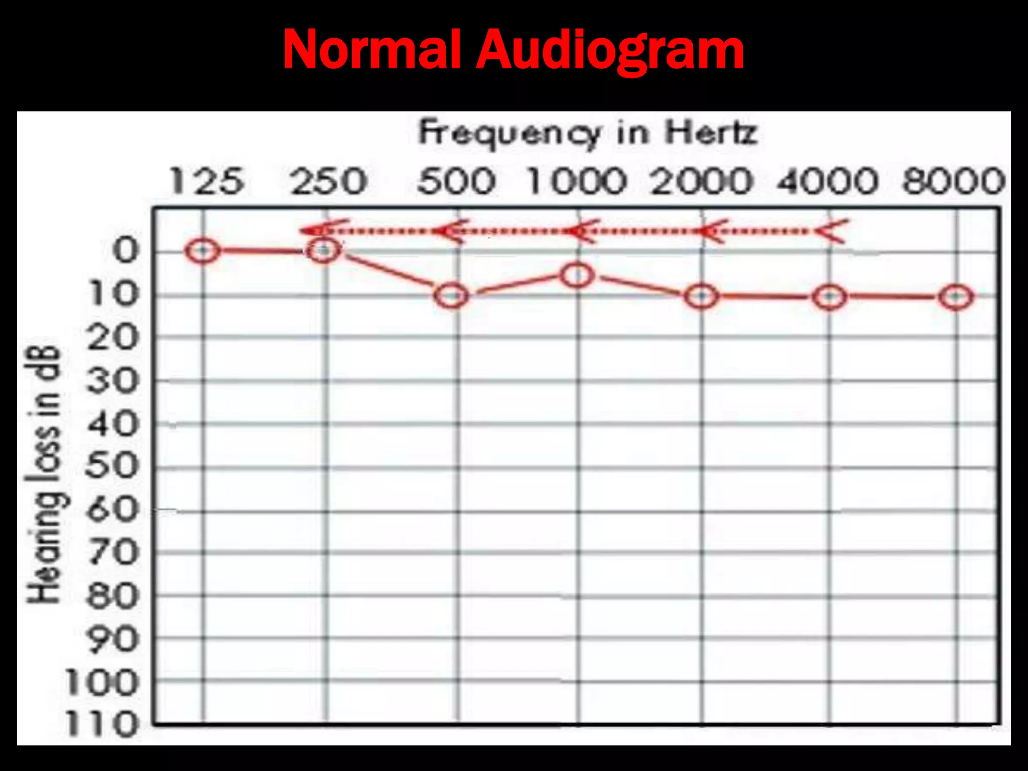 Audiometry for Undergraduate and postgraduate ENT students | PPT