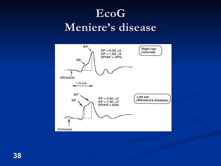 Auditory function-slides-2004-0211 2