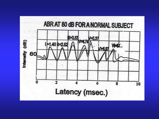 AUDITORY BRAINSTEM EVOKED RESPONSE (ABR).ppt