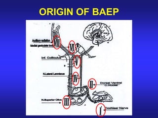 AUDITORY BRAINSTEM EVOKED RESPONSE (ABR).ppt
