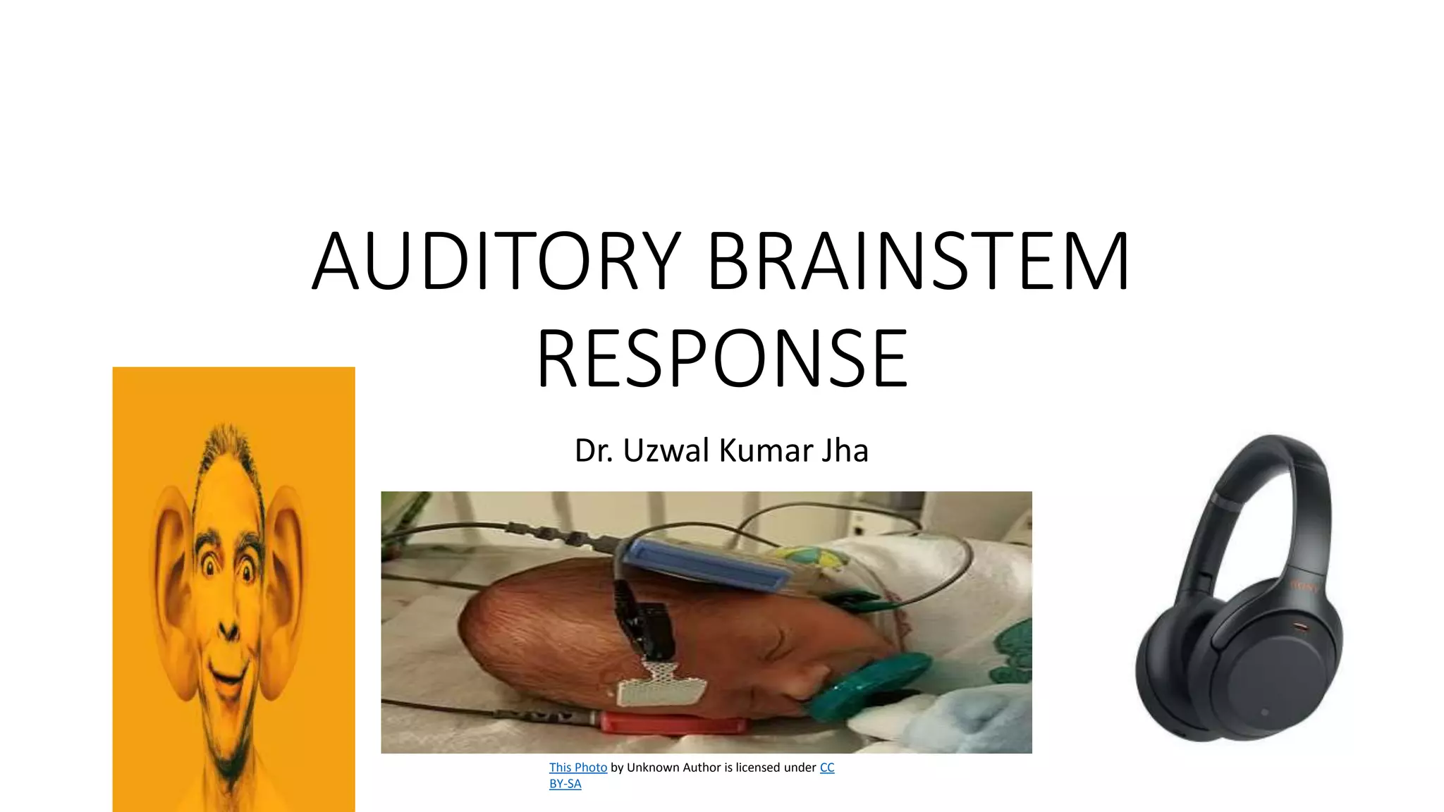 Auditory brainstem response | PPTX