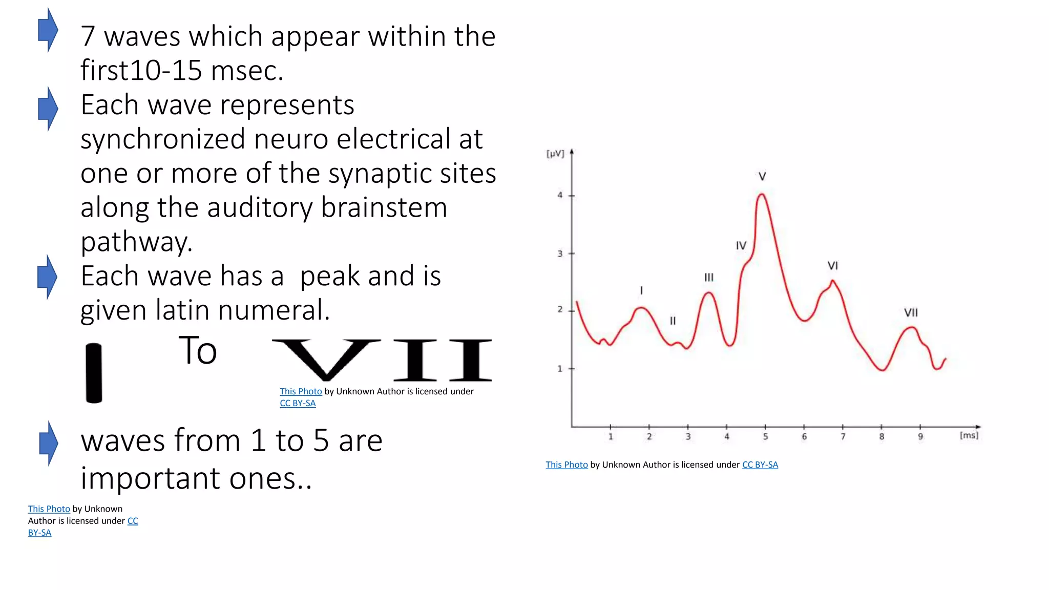 Auditory brainstem response | PPTX