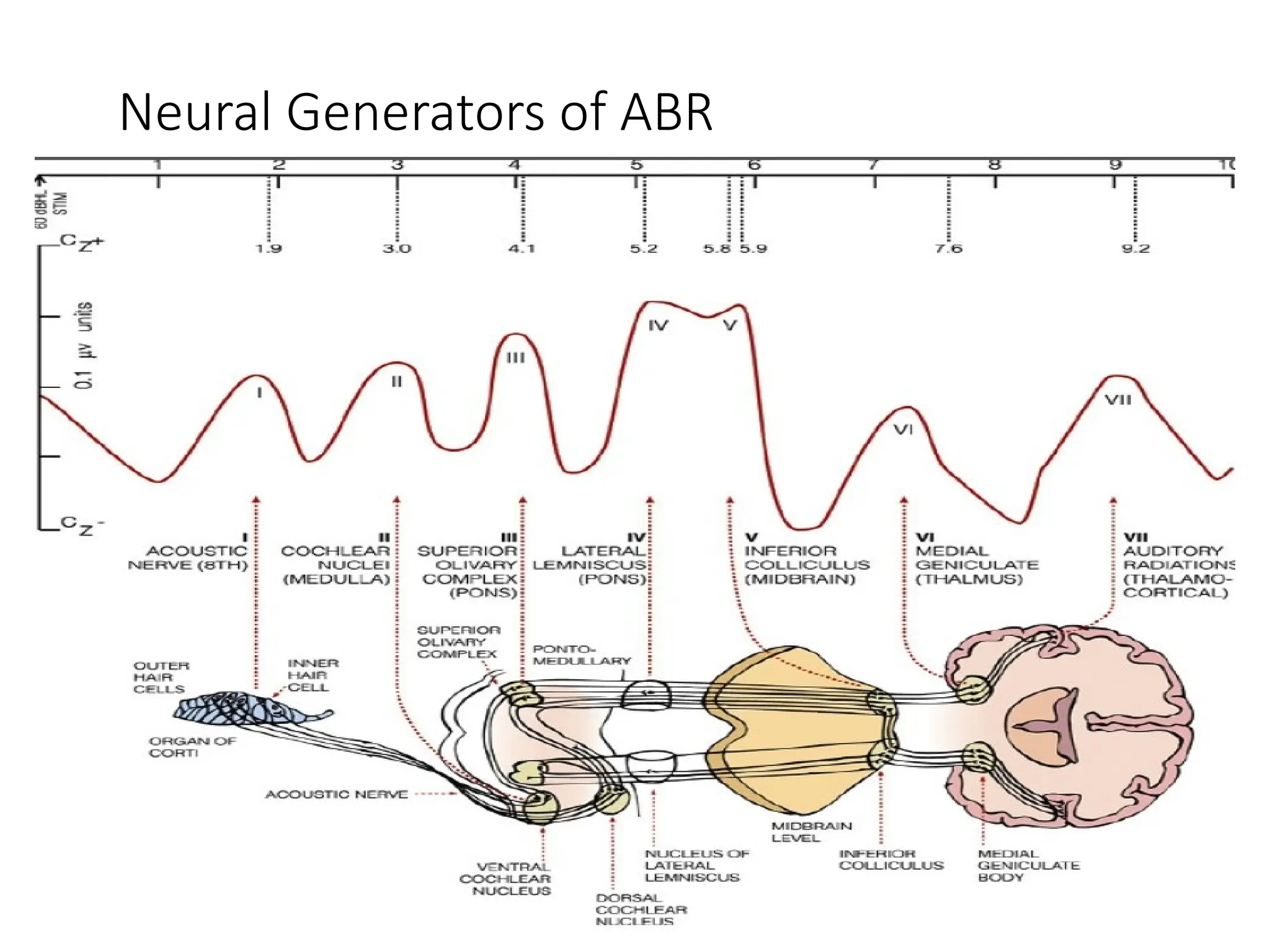 Auditory Brainstem Response ghfghhfrh.pptx