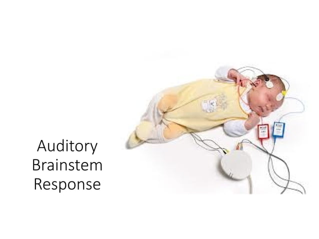 Auditory Brainstem Response ghfghhfrh.pptx