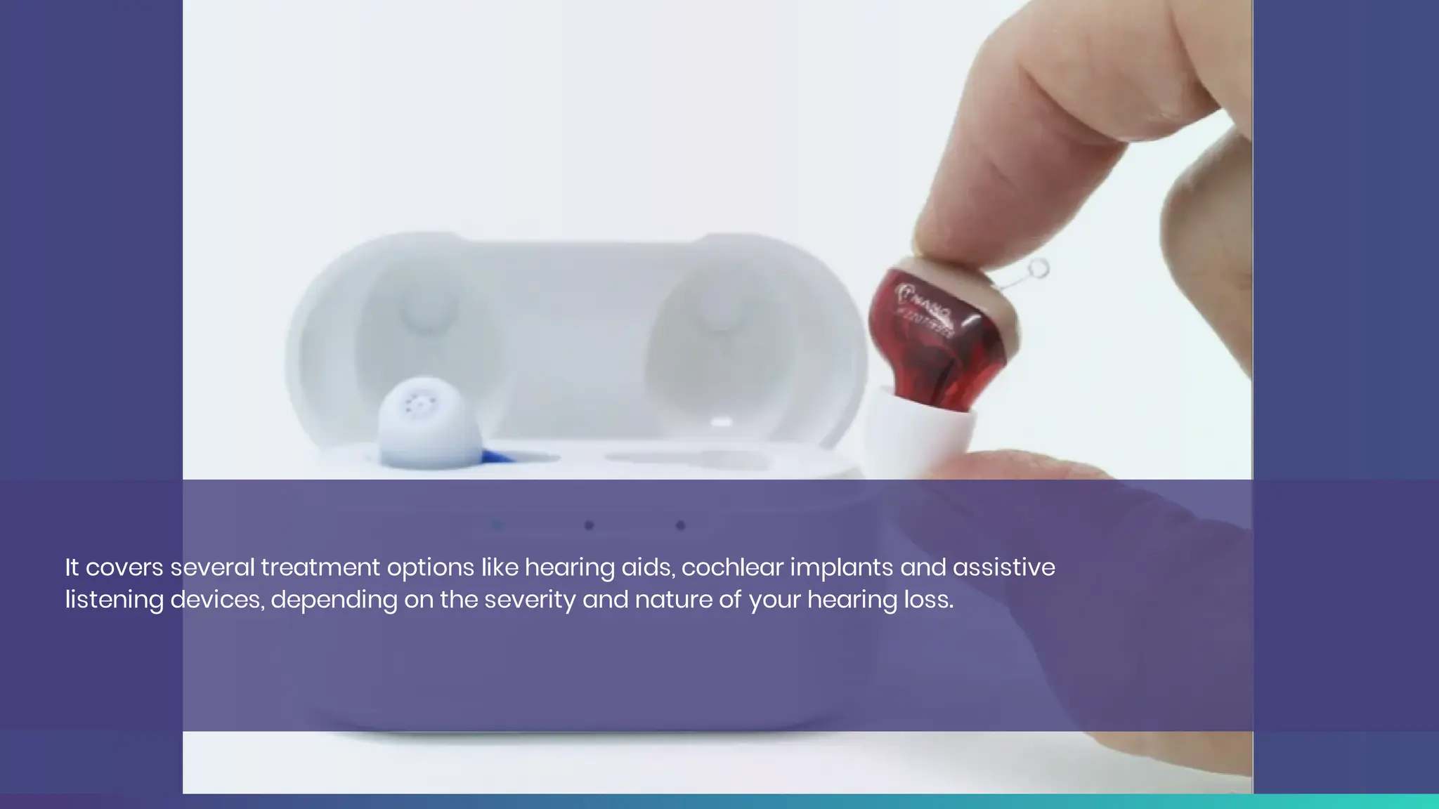 Auditory Neuropathy Causes, Symptoms & Treatment Guide Recommends OTC ...