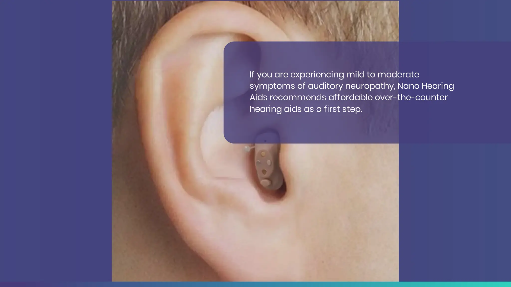 Auditory Neuropathy Causes, Symptoms & Treatment Guide Recommends OTC ...