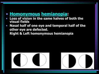 AUDITORY PATHWAY anatomy and physiologys | PPT