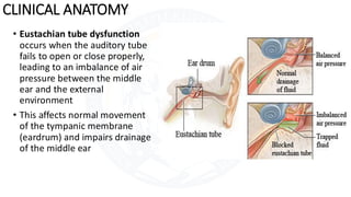 AUDITORY TUBE & VESTIBULOCOCHLEAR NERVE.pdf