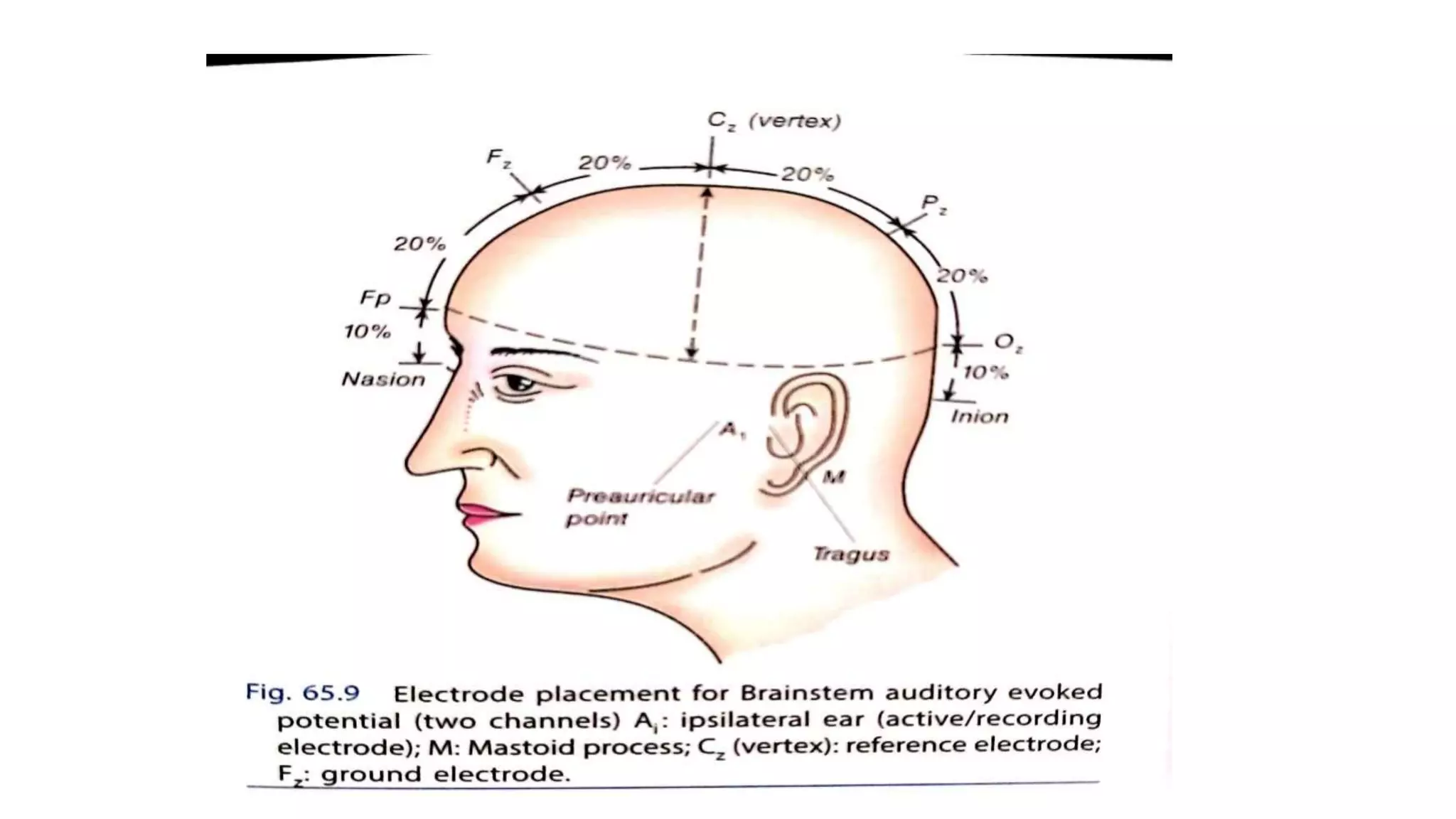 AUDITORY VISUAL EVOKED POTENTIAL.pptx