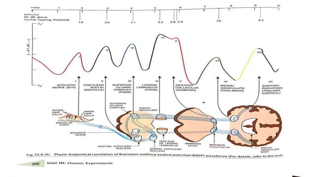 AUDITORY VISUAL EVOKED POTENTIAL.pptx | Eye and Vision Conditions | Diseases and Conditions