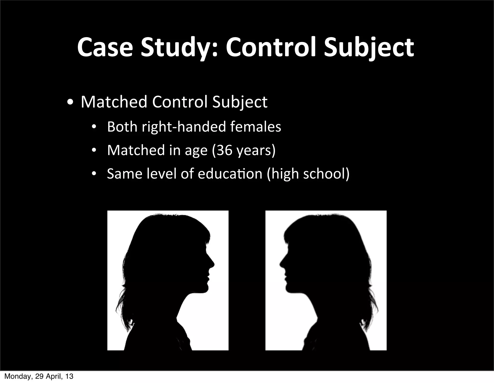 A Case Study on Auditory Verbal Hallucinations | PDF