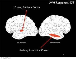 A Case Study on Auditory Verbal Hallucinations | PDF