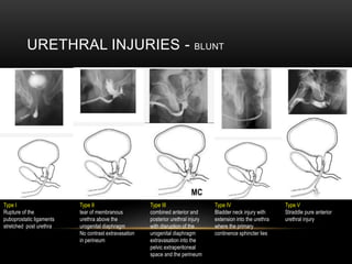 ascending urethrogram | PPTX