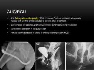 ascending urethrogram | PPTX