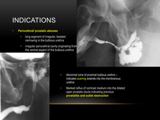 ascending urethrogram | PPTX