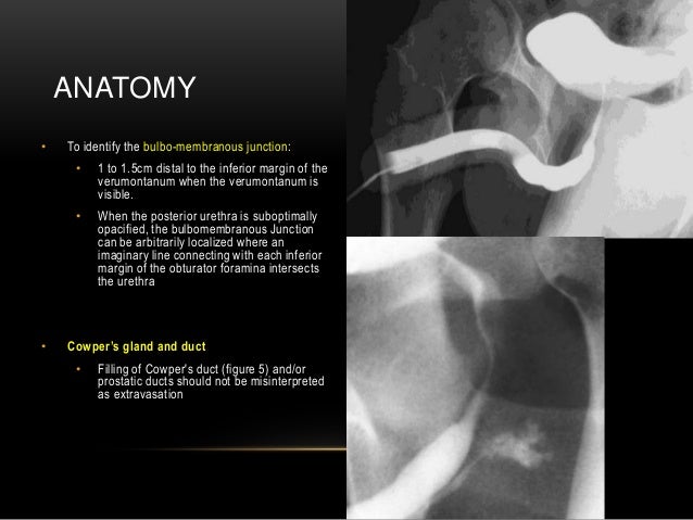 ascending urethrogram