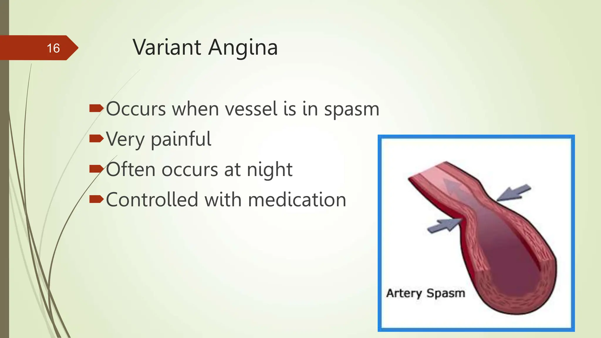 angina-acute-mi-stroke jwdyewdhfehdvecgbwcgew.ppt