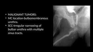 Anterior urethrogram,RETROGRADE URETHROGRAM.pptx