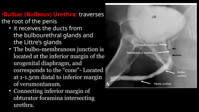 Anterior urethrogram,RETROGRADE URETHROGRAM.pptx