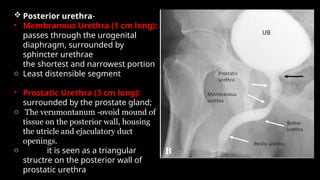Anterior urethrogram,RETROGRADE URETHROGRAM.pptx