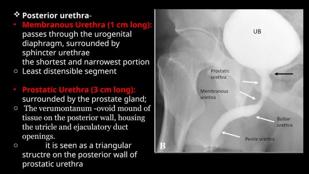 Anterior urethrogram,RETROGRADE URETHROGRAM.pptx