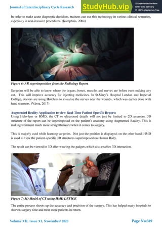 Augmented Reality (AR) In Healthcare | PDF