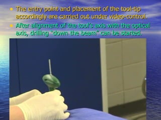 Augmented reality in spine surgery | PPT