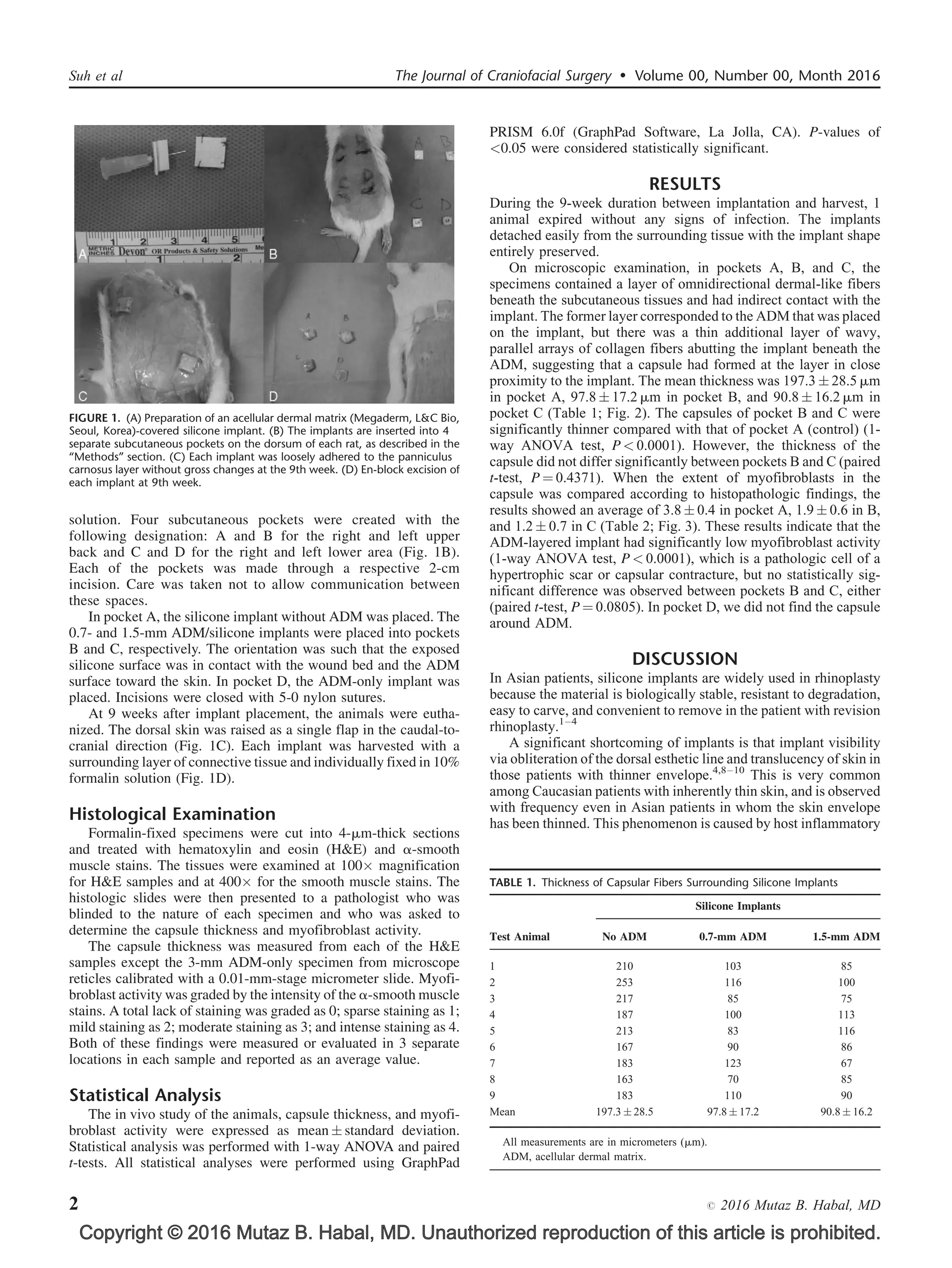 Augmentation rhinoplasty with silicone implant covered with acellular ...