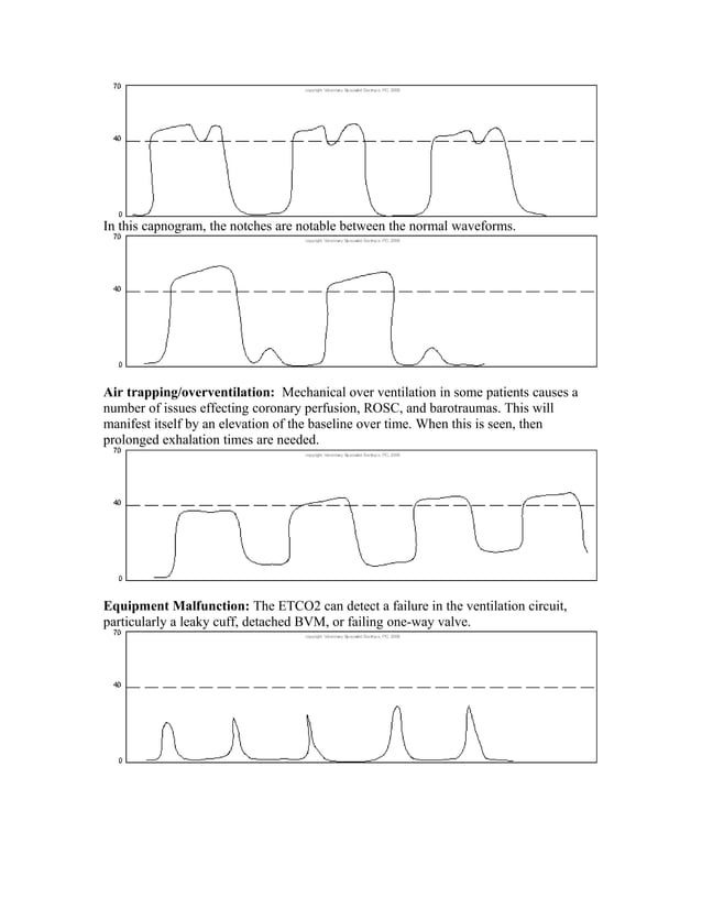 Capnography overview for ems.cole