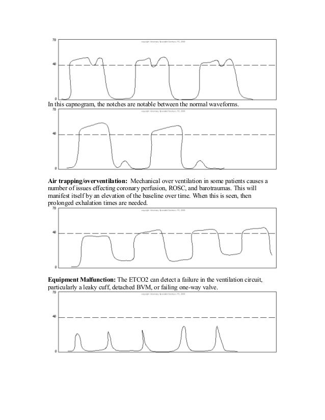Capnography overview for ems.cole