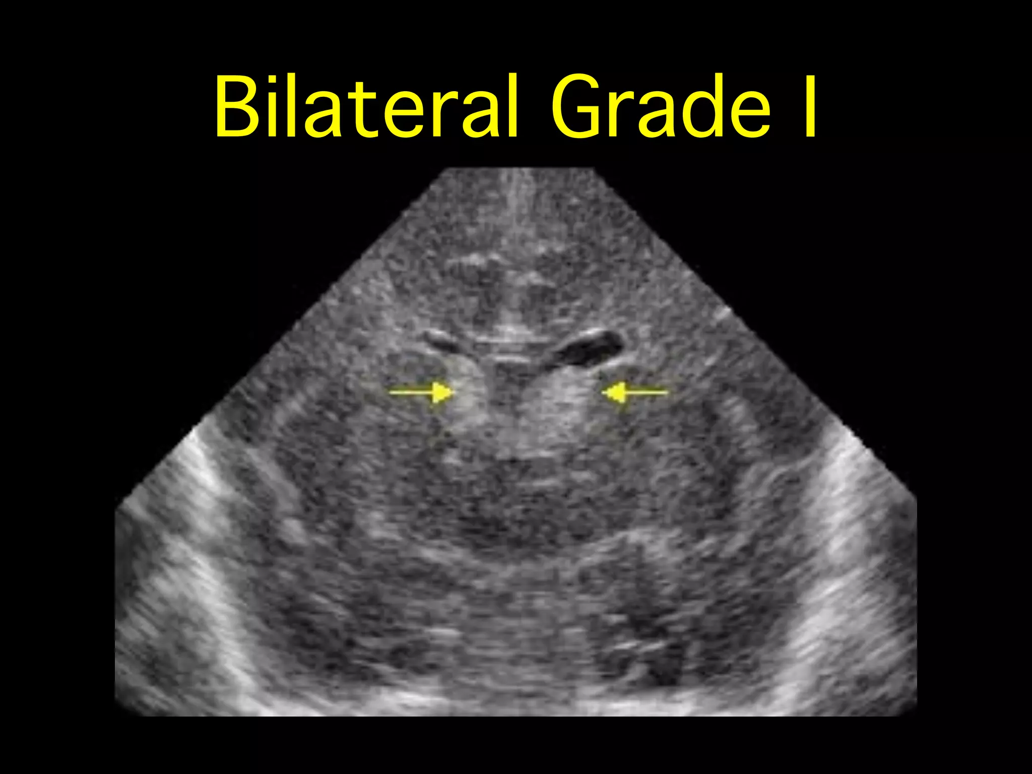 Neonatal Cranial & Spinal Ultrasound | PDF