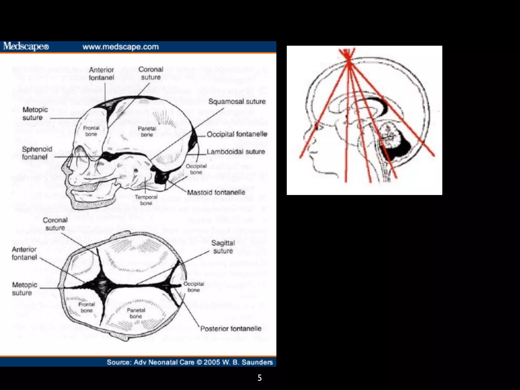 Neonatal Cranial & Spinal Ultrasound | PDF
