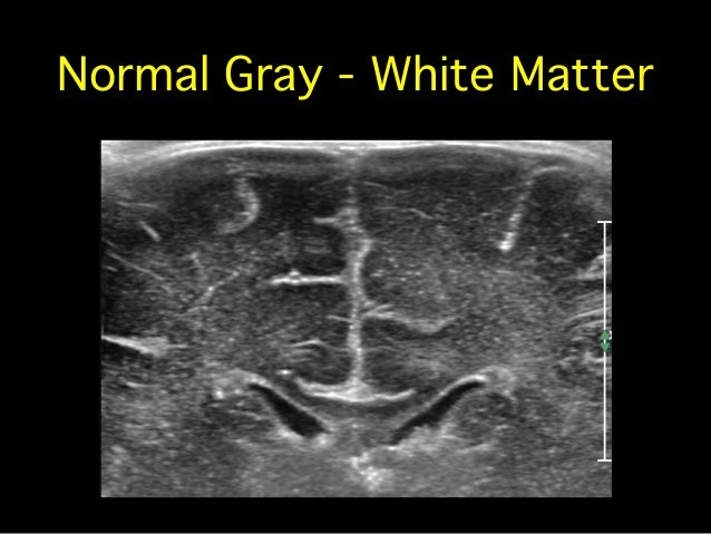 Neonatal Cranial & Spinal Ultrasound
