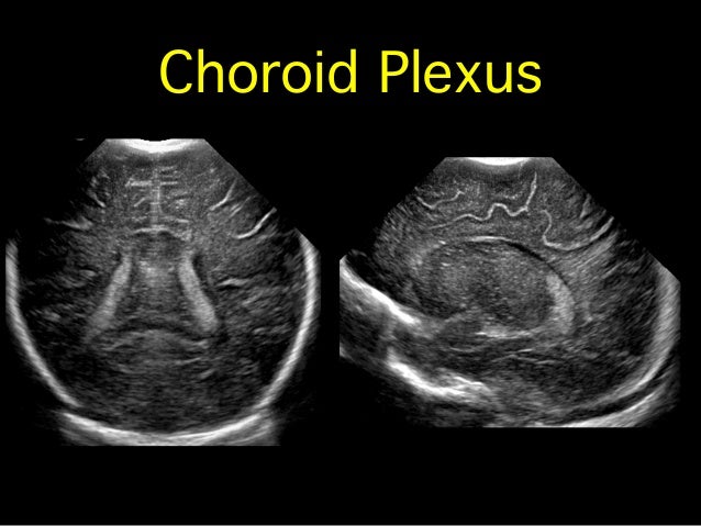 Neonatal Cranial & Spinal Ultrasound