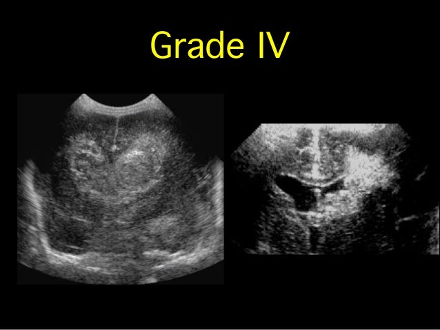 Neonatal Cranial & Spinal Ultrasound