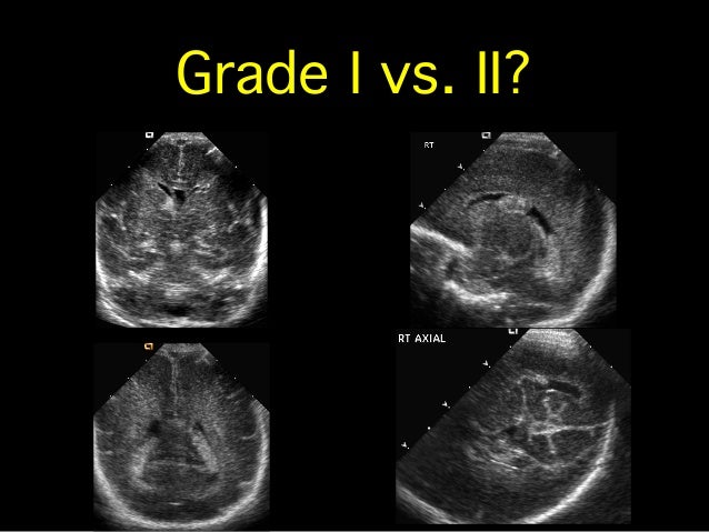 Neonatal Cranial & Spinal Ultrasound