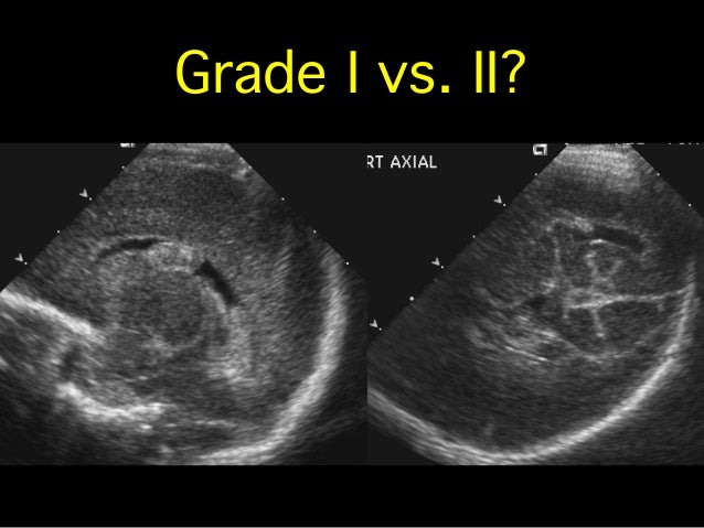 Neonatal Cranial & Spinal Ultrasound
