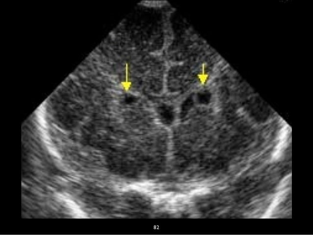 Neonatal Cranial & Spinal Ultrasound