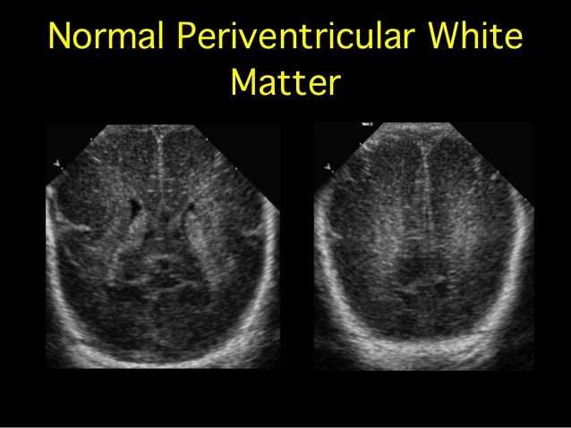 Neonatal Cranial & Spinal Ultrasound