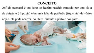 Hospital de Songo AUGUSTA ASFIXIA NEONATAL.pptx