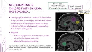Dyslexia: a case study of everyday neurobiology | PDF