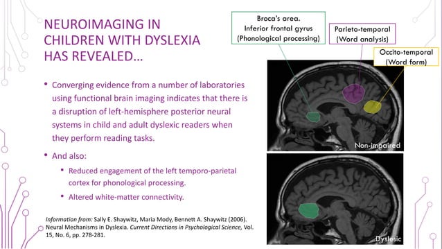 Dyslexia: a case study of everyday neurobiology | PPT