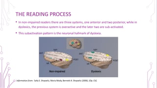 Dyslexia: a case study of everyday neurobiology | PPT