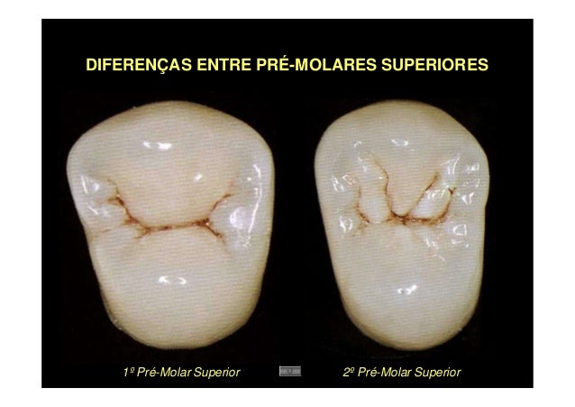 Premolares Superiores